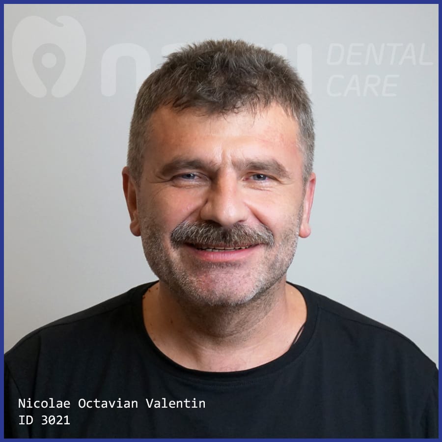 Cleaning and Polishing | Navii Dental Care | The Biggest Dental Center ...